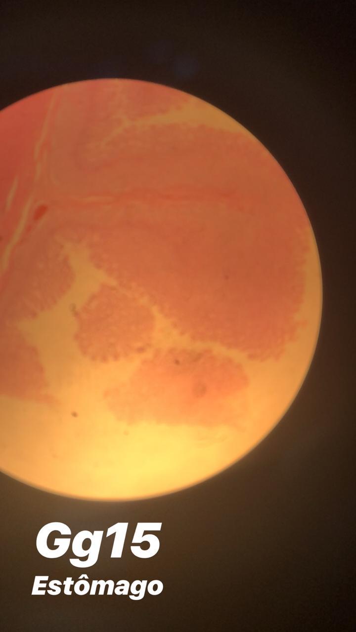 Tipos De Tecidos Flashcards Memorang