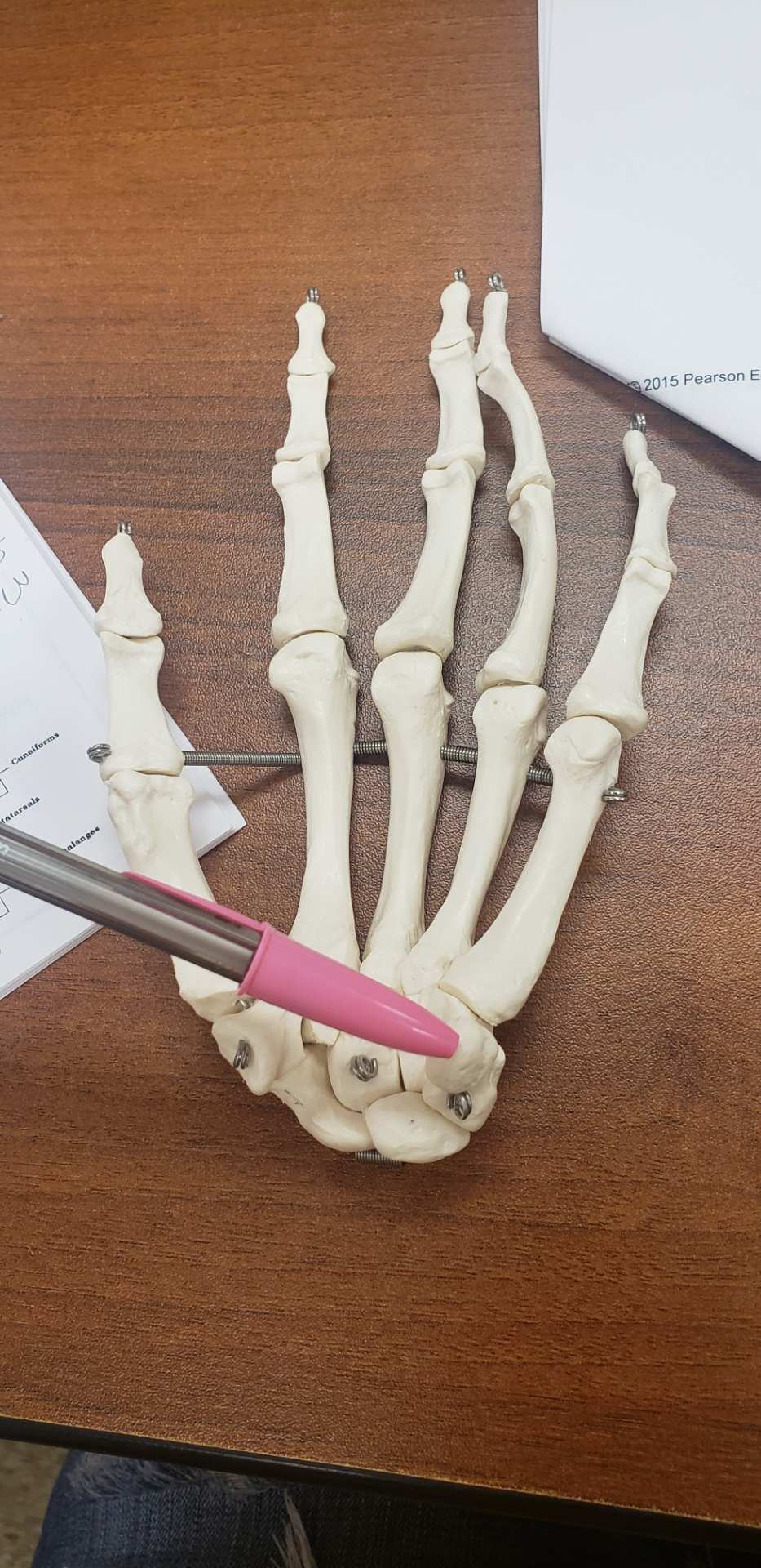 Hand bones lab 3 Flashcards | Memorang