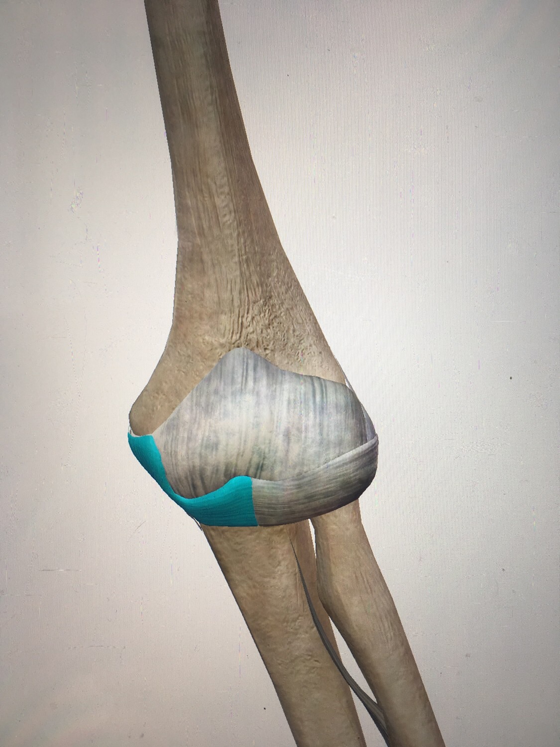 Ligaments Flashcards | Memorang