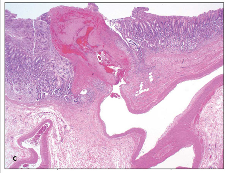Stomach histology Flashcards | Memorang