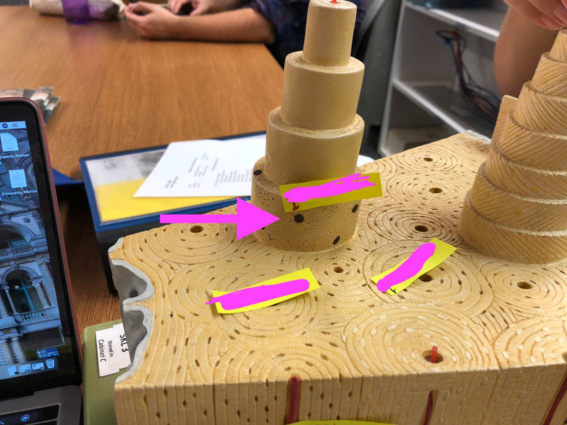 Compact Bone Identification Flashcards | Memorang