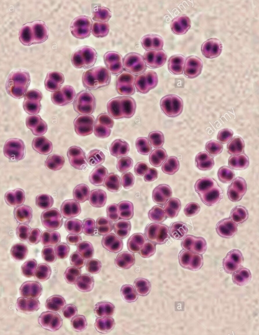Microbiologia Clinica - Técnicas de Coloração Flashcards | Memorang