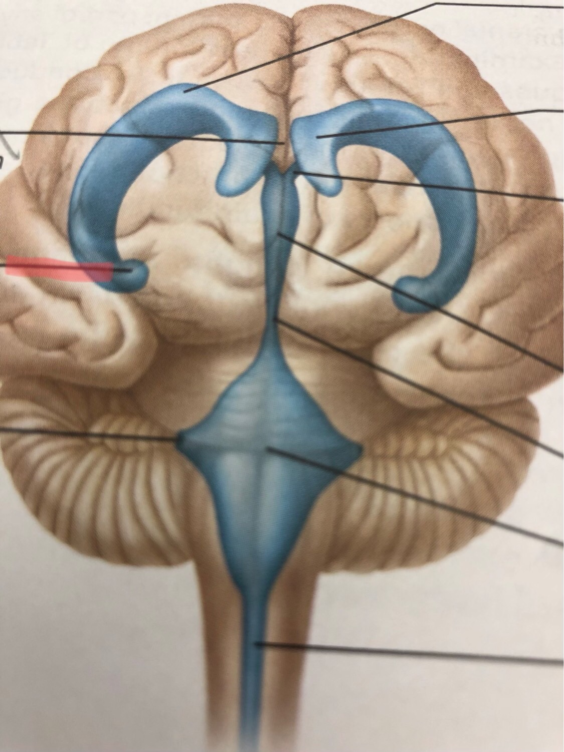 Ventricles Flashcards | Memorang