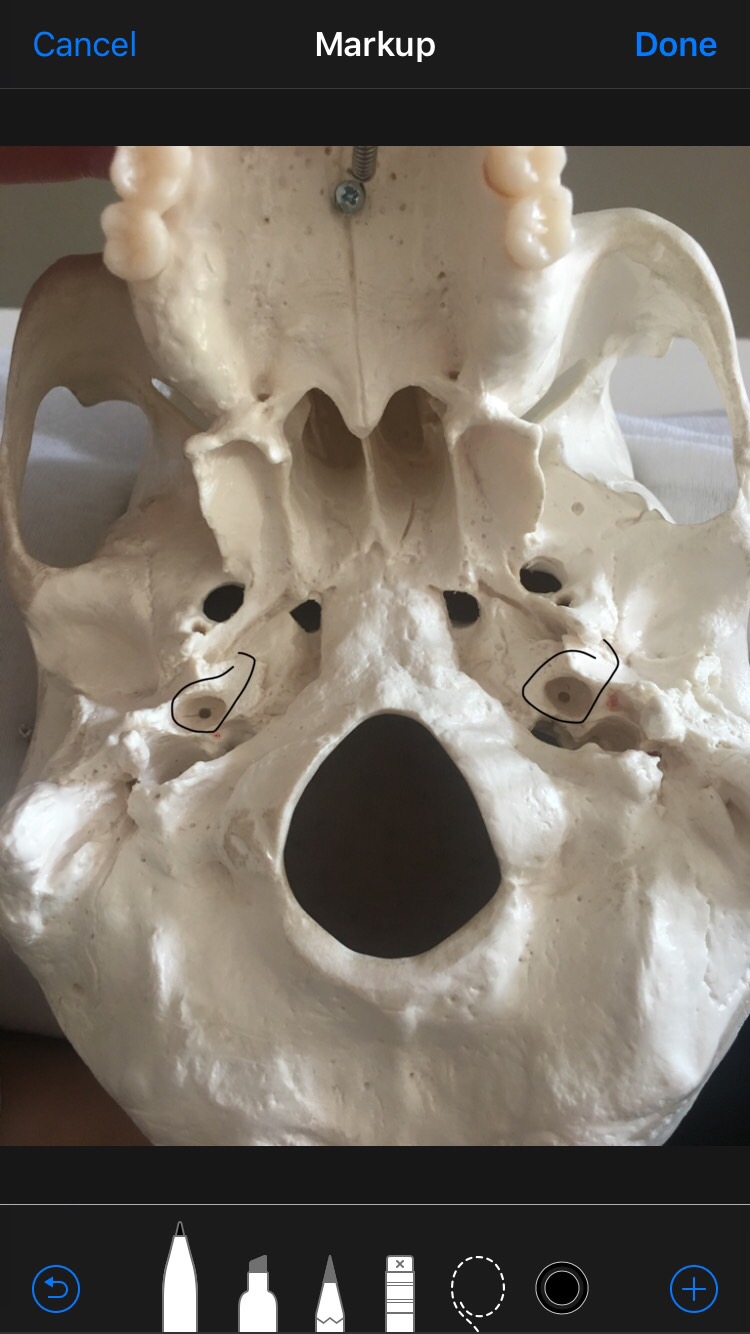 Skallen Flashcards | Memorang