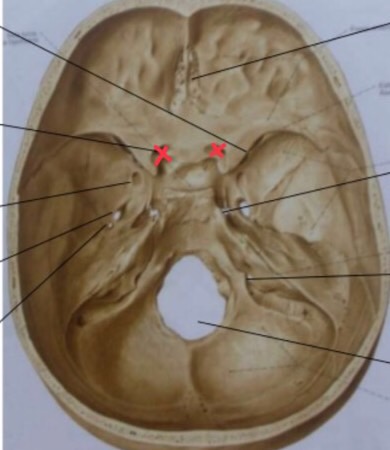Forâmes do Crânio Flashcards | Memorang