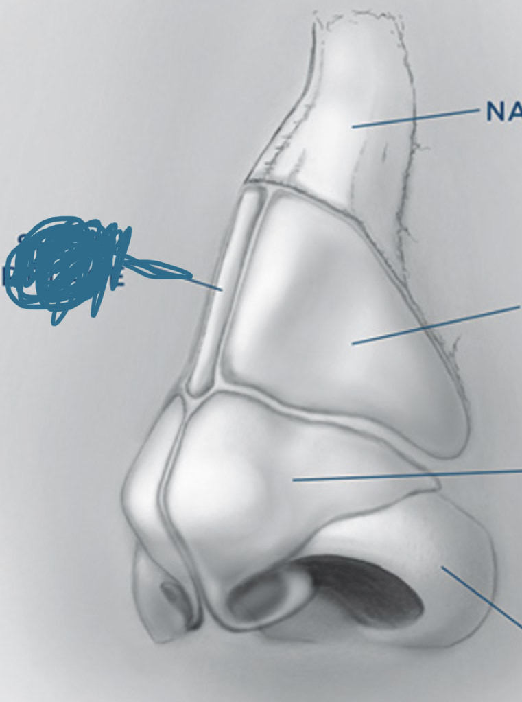 Cartilage of the Nose and Ears Flashcards | Memorang