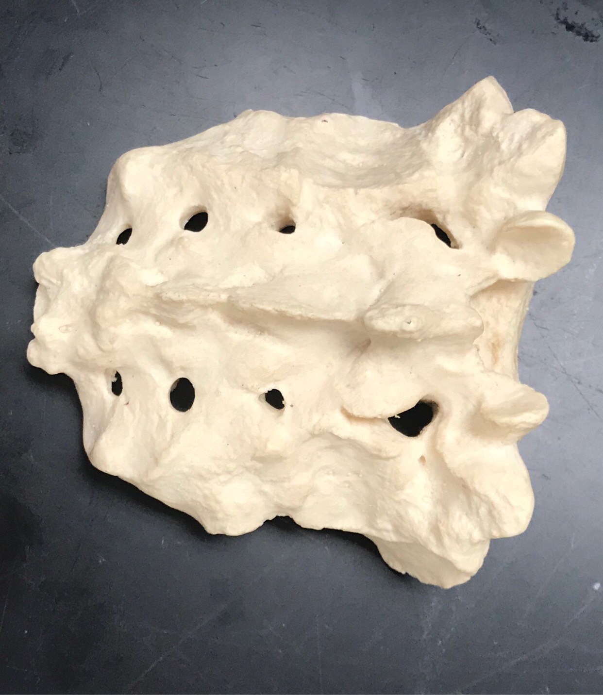 Anatomy and physiology Bone classification Flashcards | Memorang