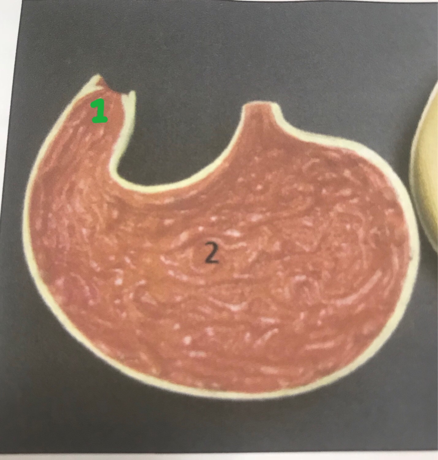 Stomach model from torso Flashcards | Memorang