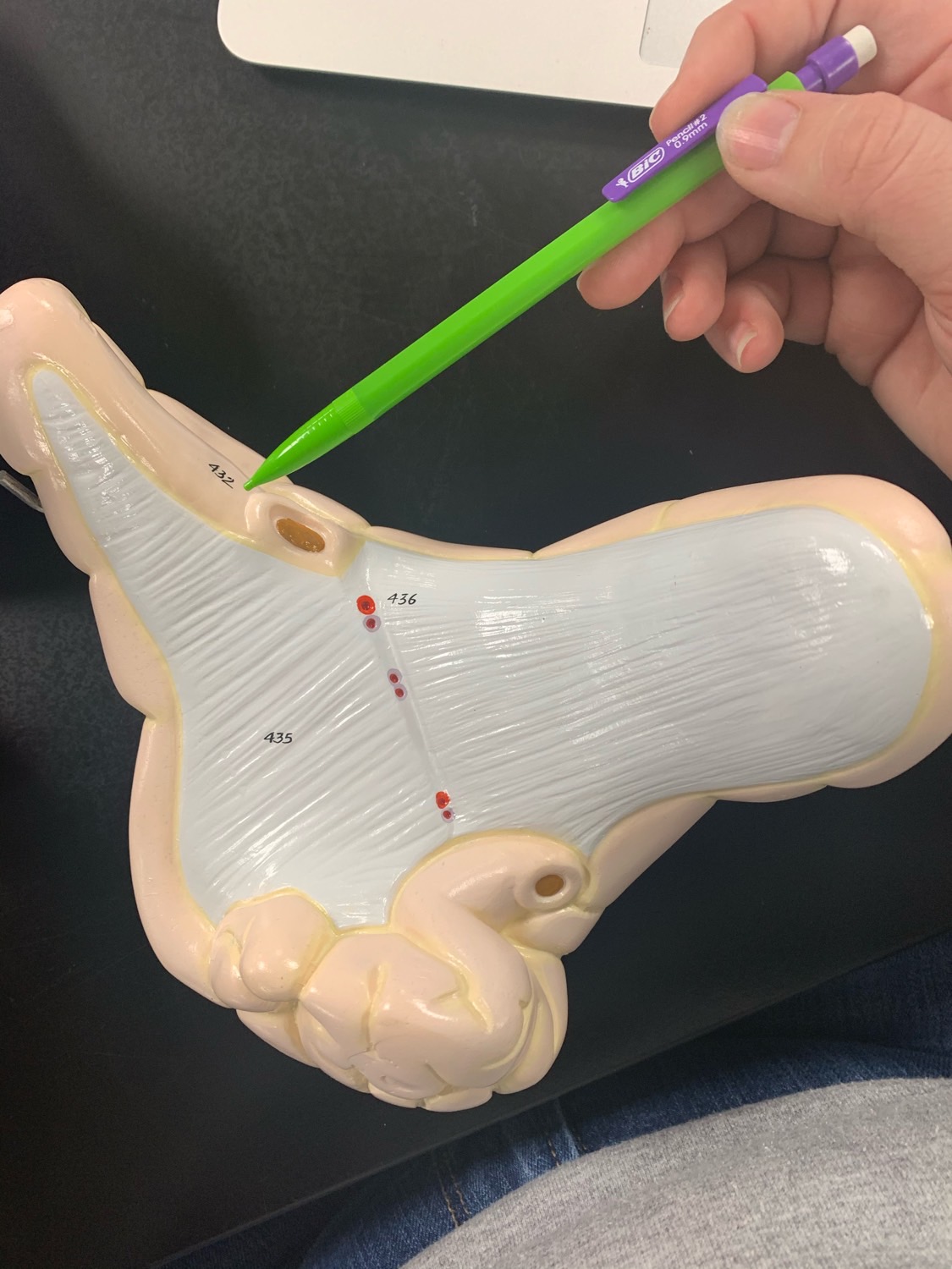 Intestines Flashcards | Memorang