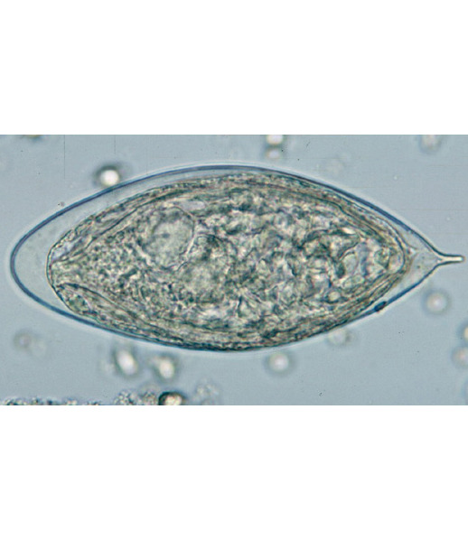 Vermes Flashcards | Memorang