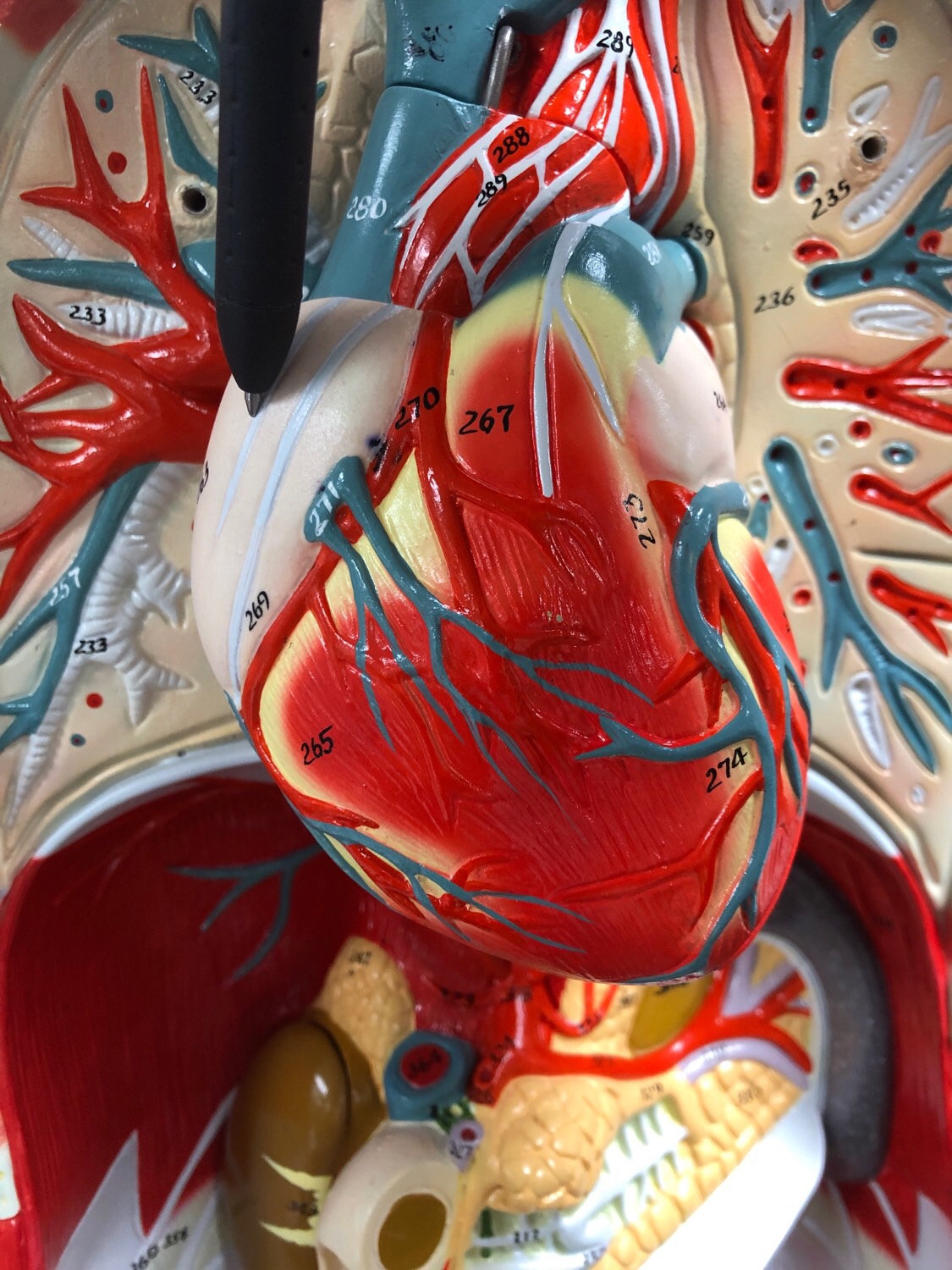 Torso model of the heart Galen Lab Flashcards | Memorang