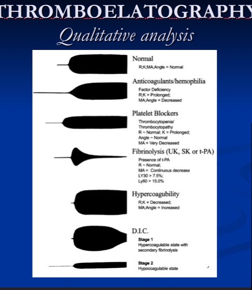TEG Flashcards | Memorang
