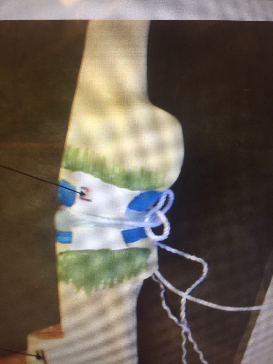 Inner bone Flashcards | Memorang