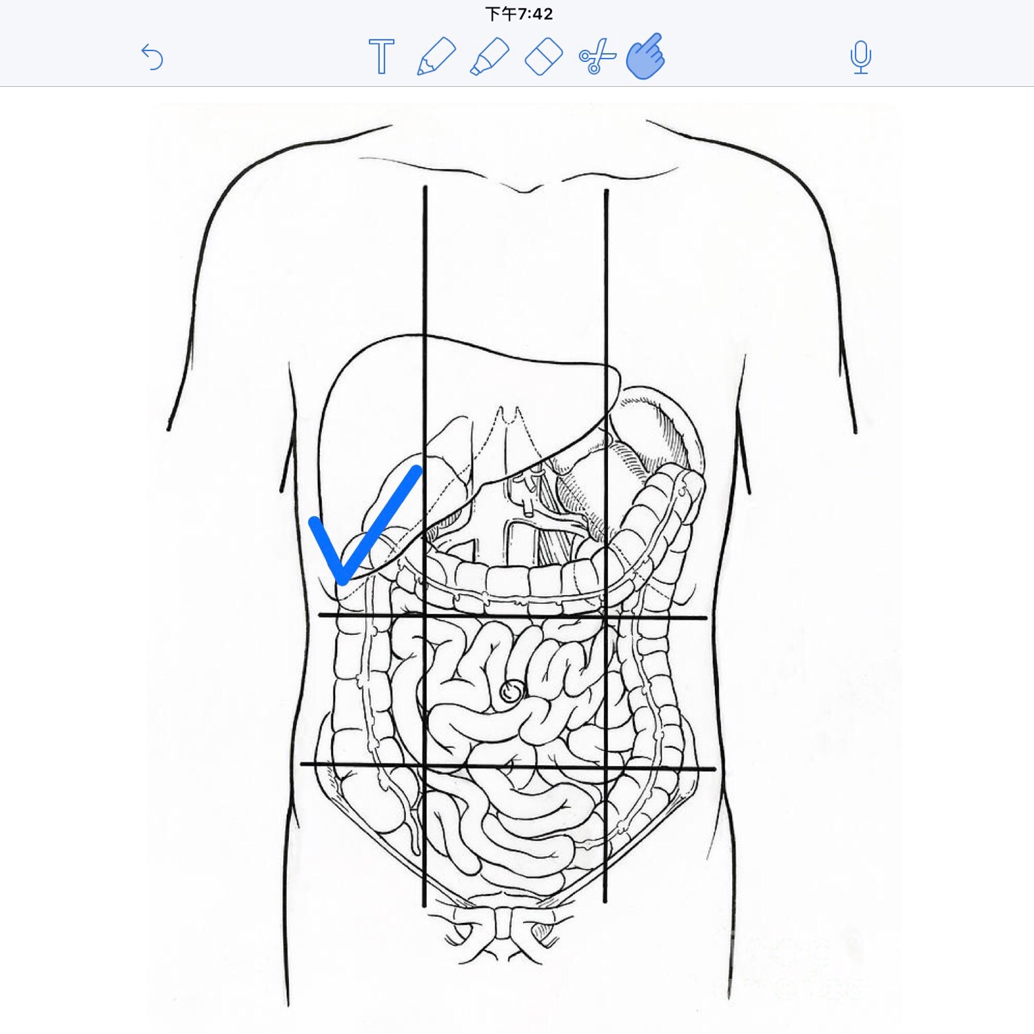 Nine regions of abdominopelvic Flashcards | Memorang