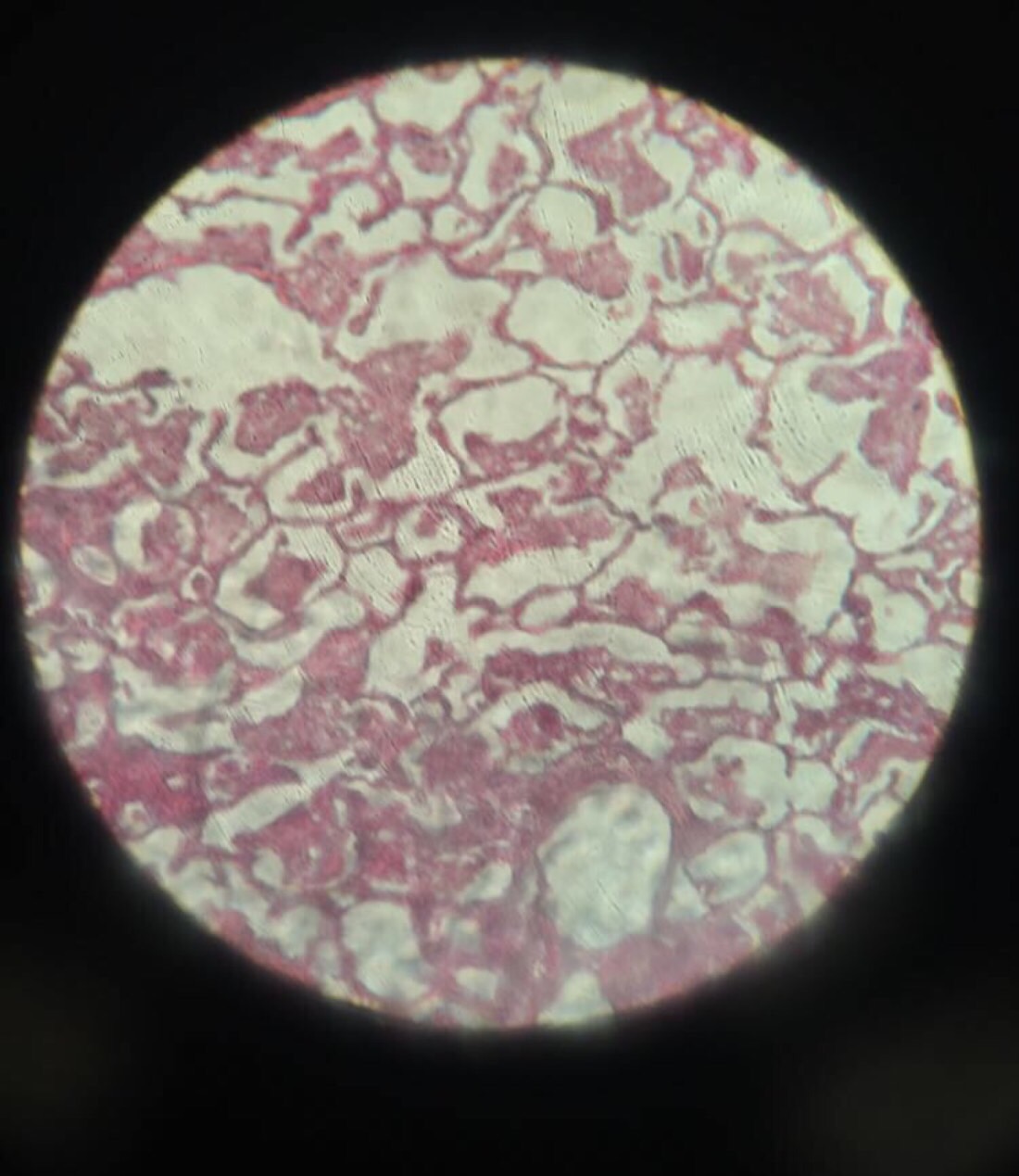 Placas de patología Flashcards | Memorang