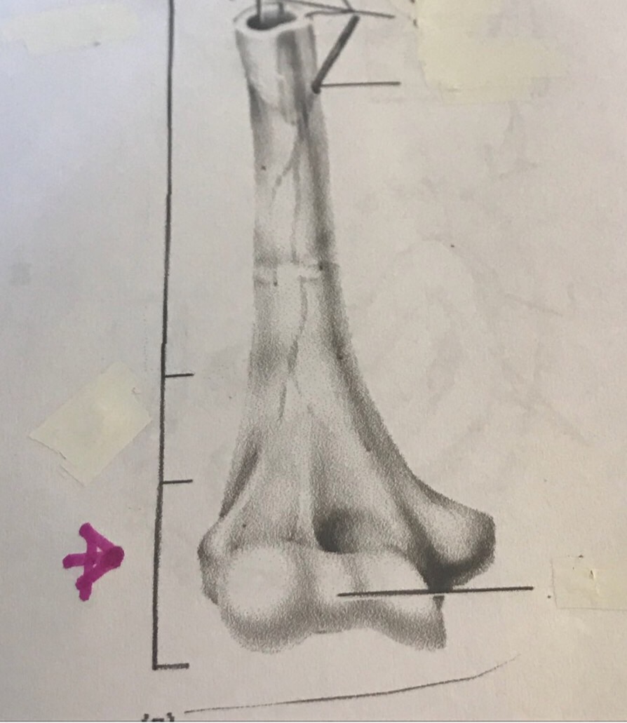 Parts of long bone Flashcards | Memorang