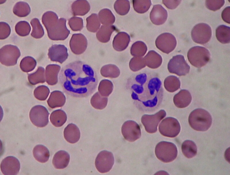 A&P Lab Blood Flashcards | Memorang