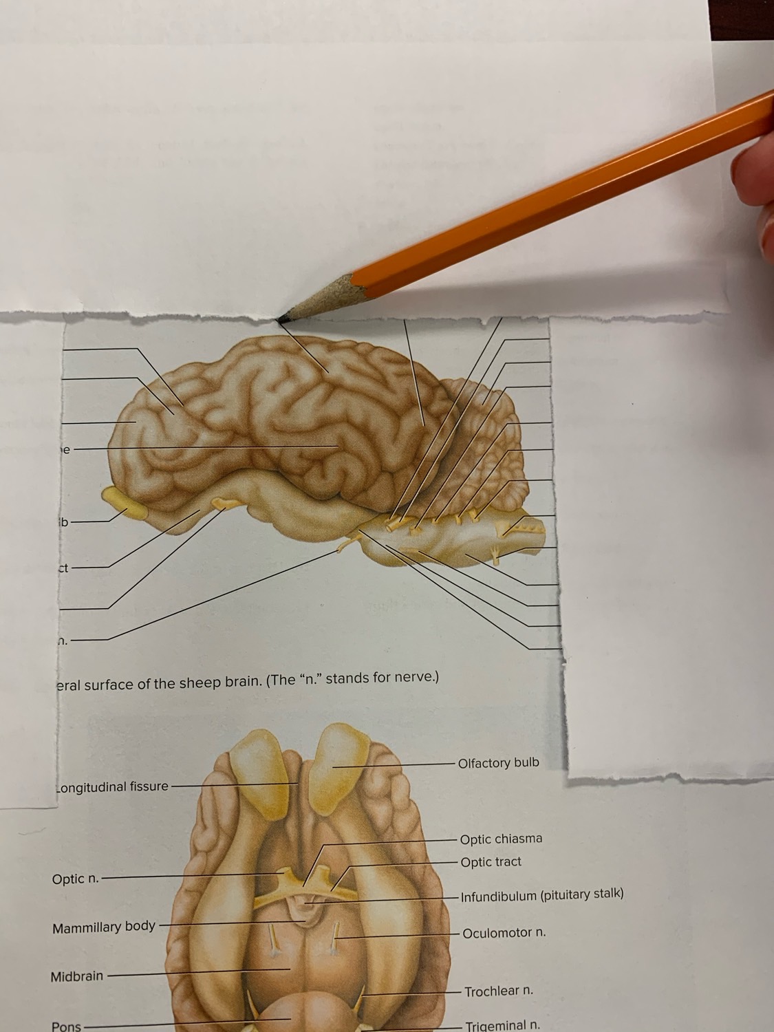 Lateral sheep’s brain Flashcards | Memorang