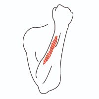 Attacking and blocking tools Flashcards | Memorang