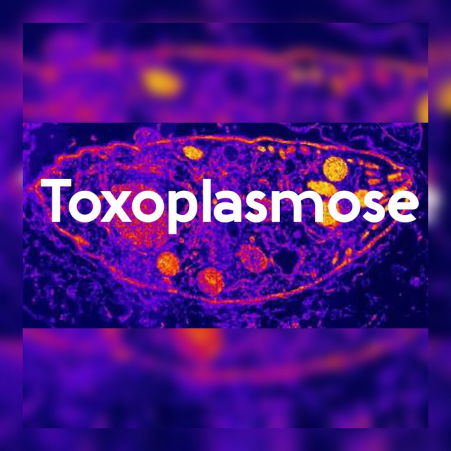 Toxoplasmose Flashcards | Memorang