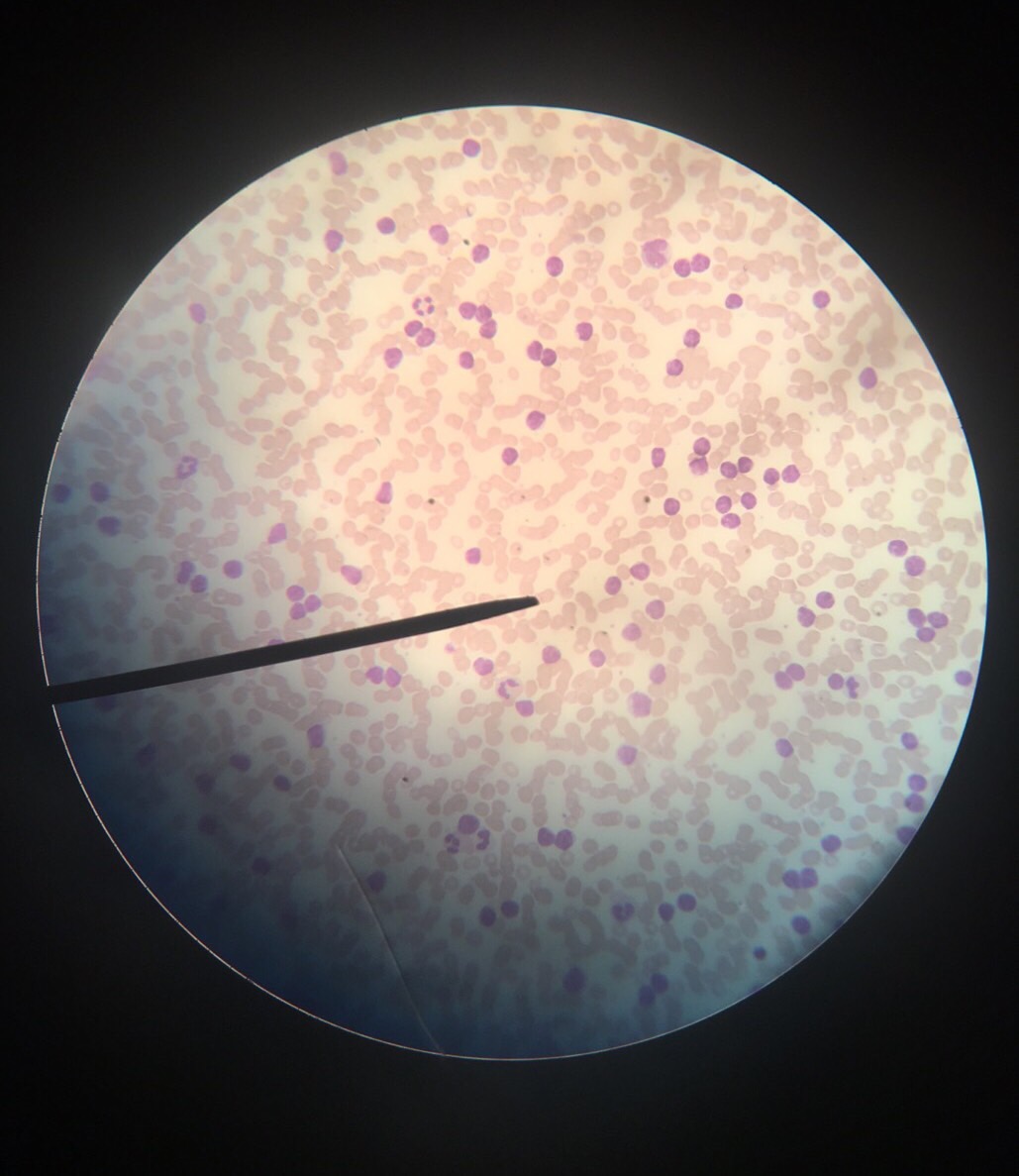 Lymphatic System Microscope Images Flashcards | Memorang