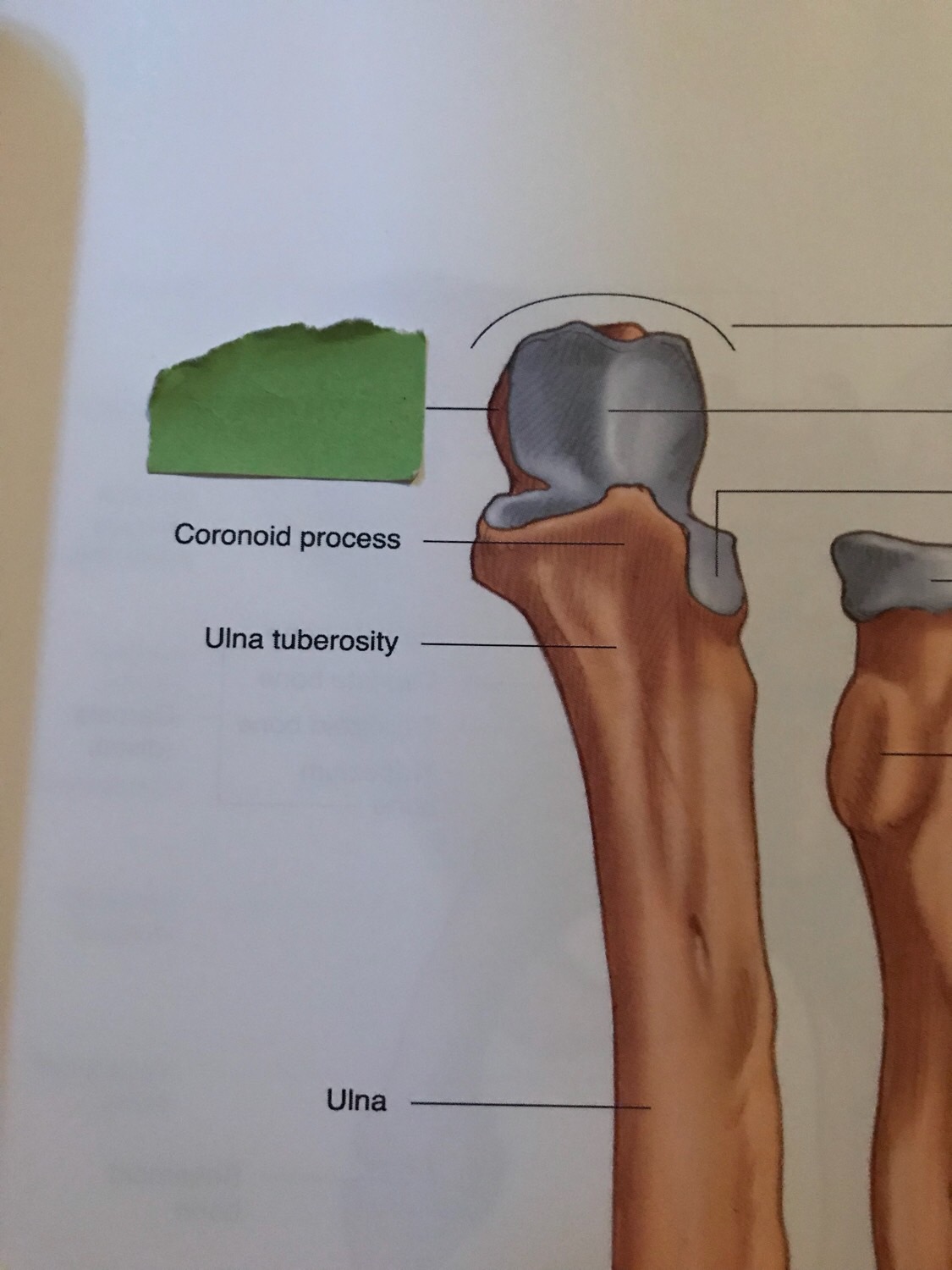 Anterior View of Left ulna and radius Flashcards | Memorang
