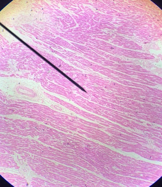 PATHO | 2-1 | Scanner View Flashcards | Memorang
