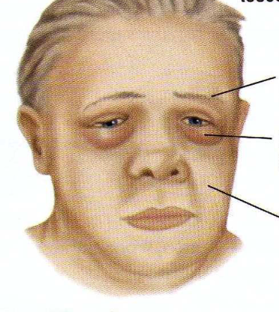 Semiología de Taca - 1er parcial imágenes Flashcards | Memorang