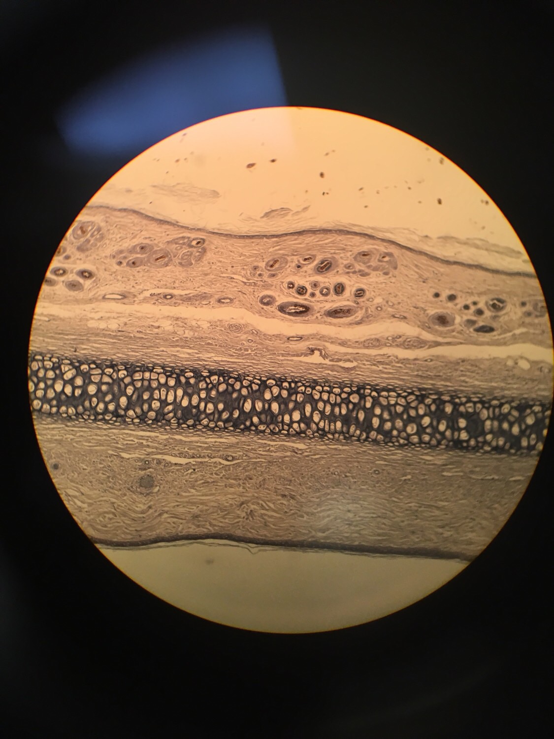 Bone Tissue and Cartilage Flashcards | Memorang