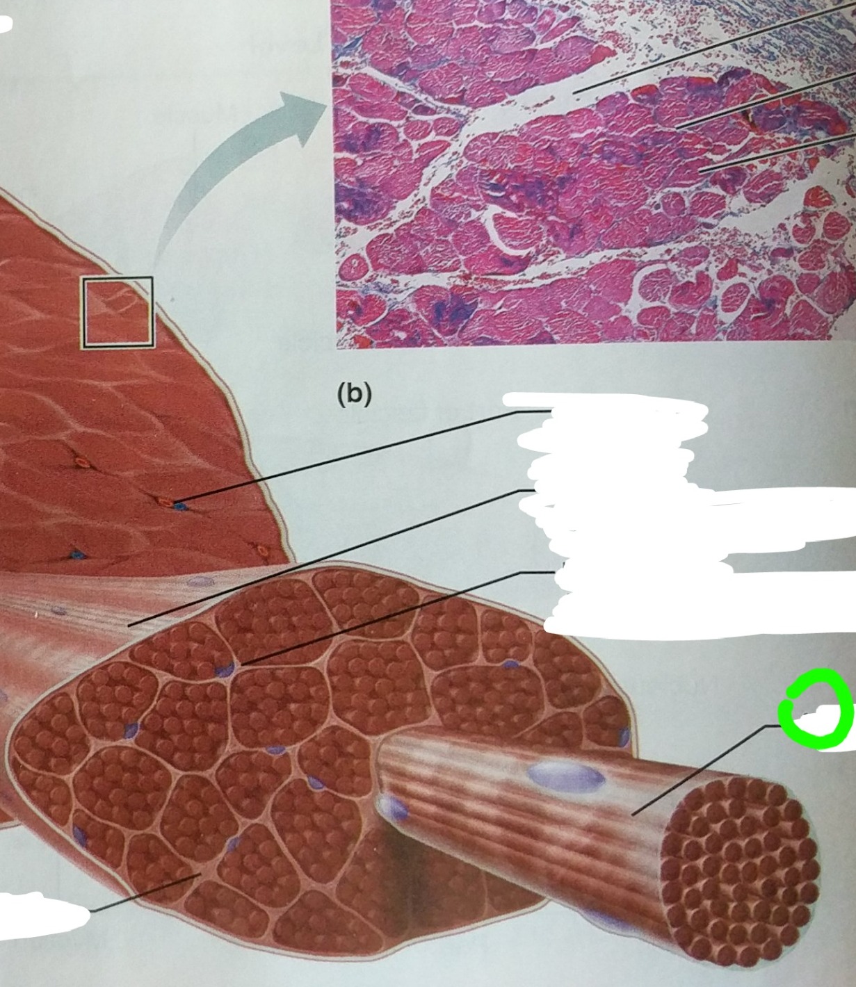 Structure of Skeletal Muscle Tissue Flashcards | Memorang