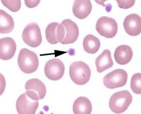 Trombocyten Flashcards | Memorang