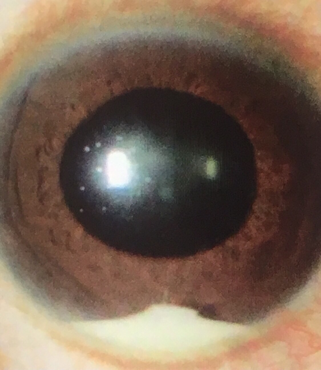 Oftalmo 1 Flashcards | Memorang