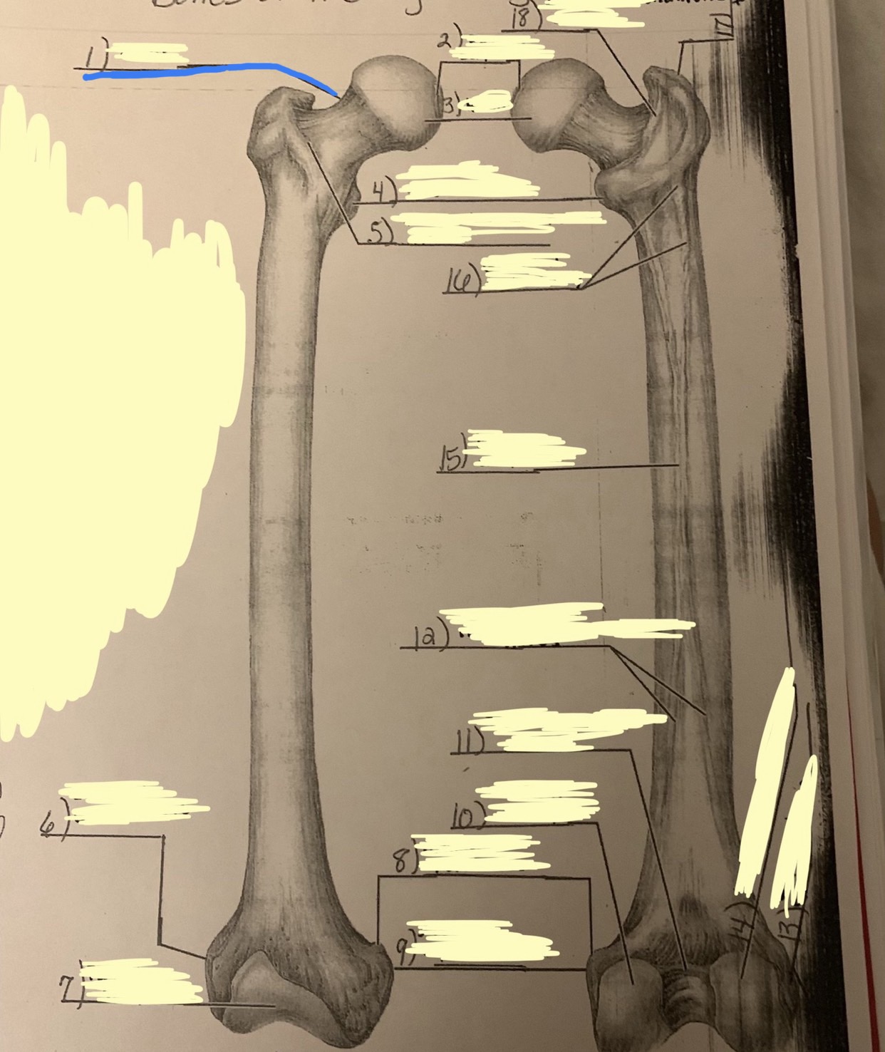 Bones of Right Thigh Flashcards | Memorang