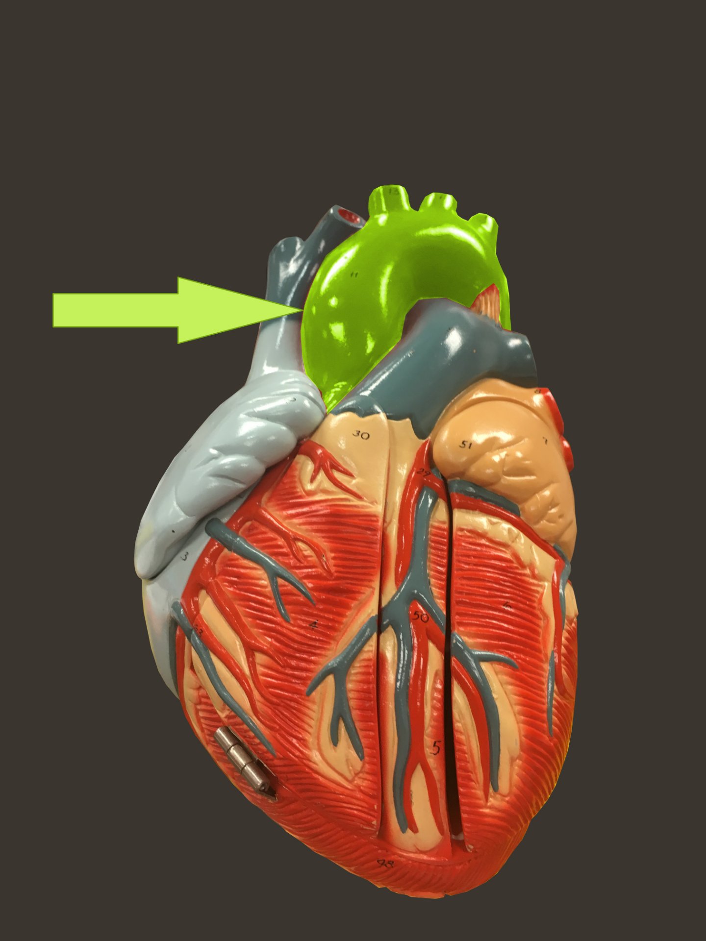A&P 2: Heart Identification Flashcards | Memorang