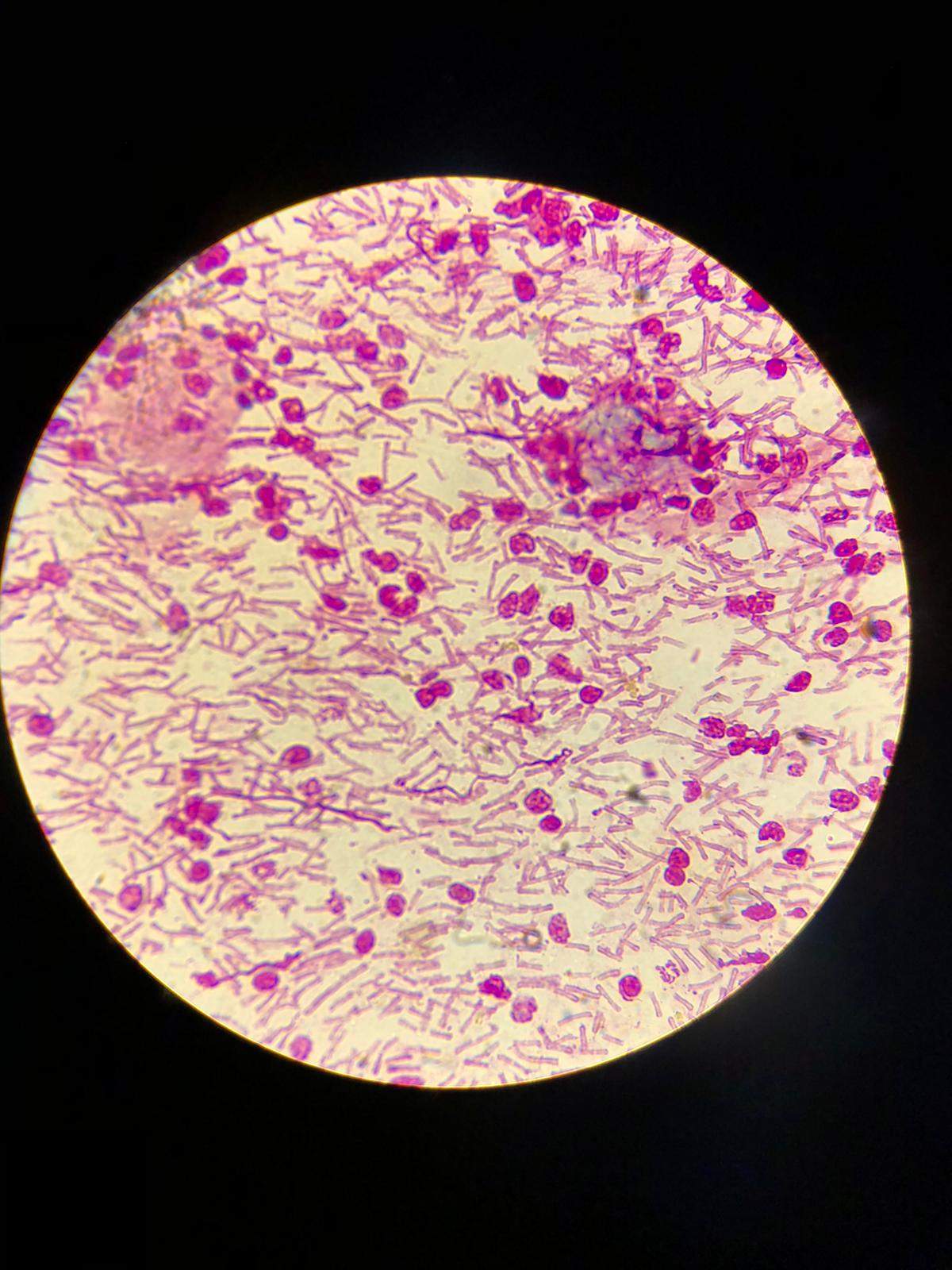 Microbiology slides Flashcards | Memorang