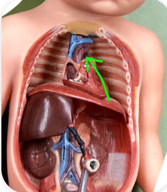 A&P 2 final practice Flashcards | Memorang