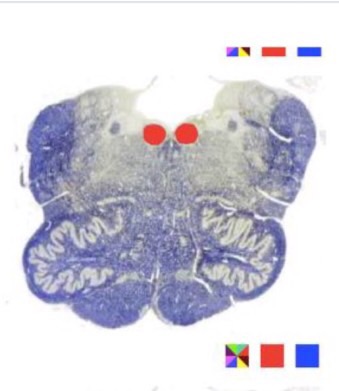 NeuroLab10 Flashcards | Memorang