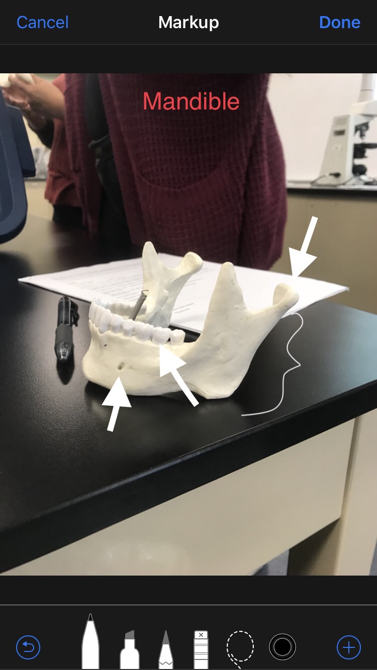 Facial Bones Flashcards | Memorang