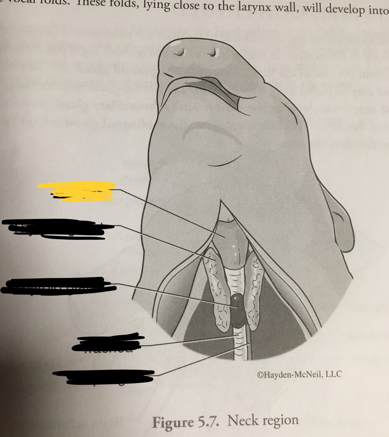 Lab 5- identify structures Flashcards | Memorang