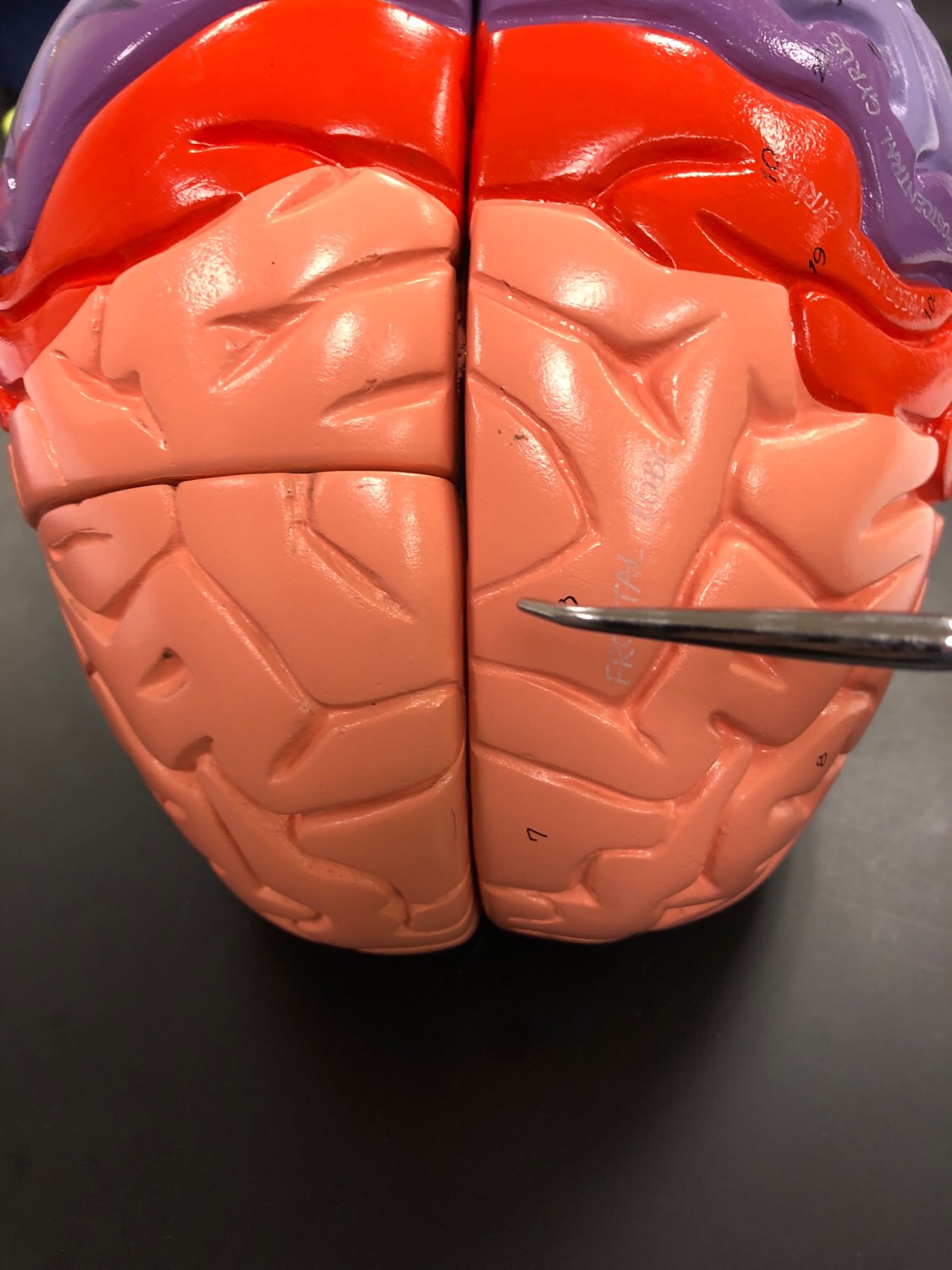 The Brain Flashcards | Memorang