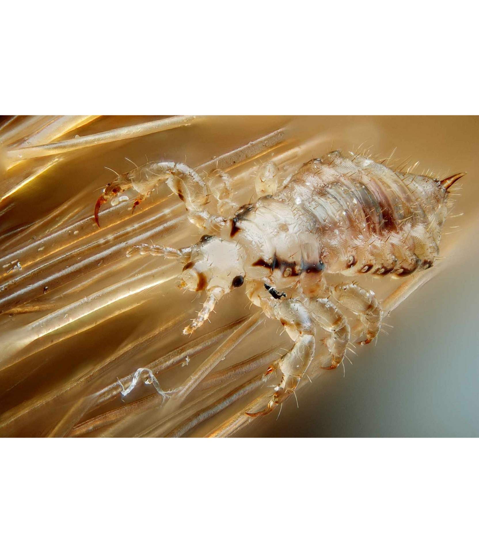 Třída hmyz Flashcards | Memorang