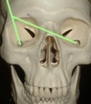 Bone Structures Flashcards | Memorang