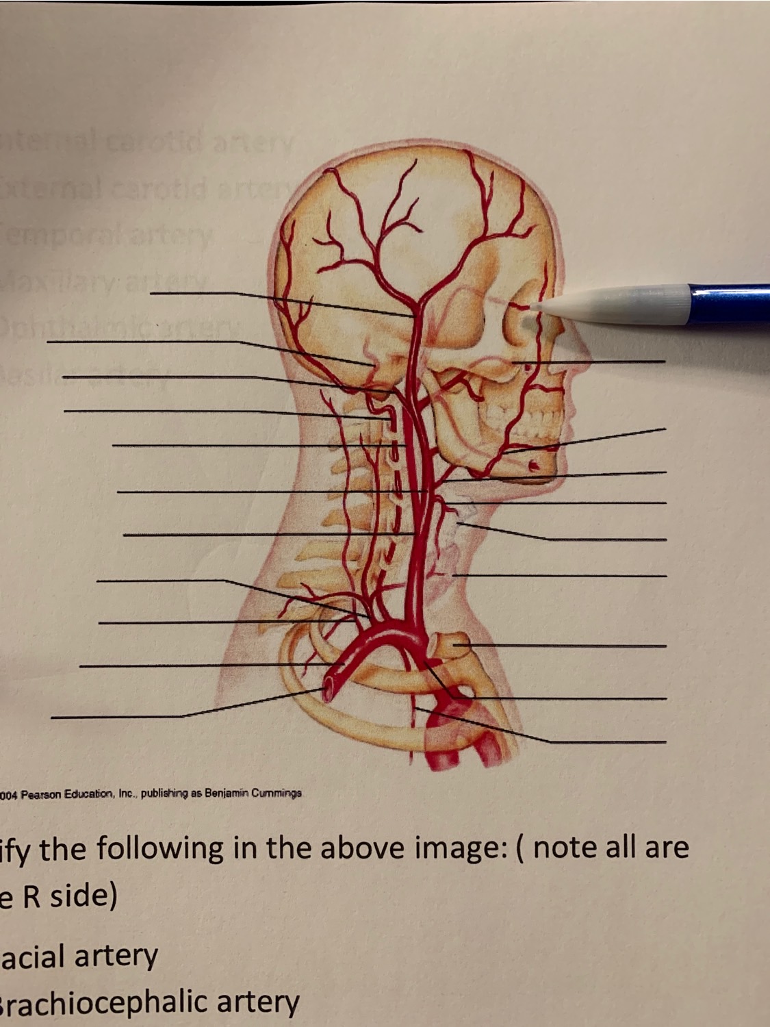 Head and Upper body arteries Flashcards | Memorang