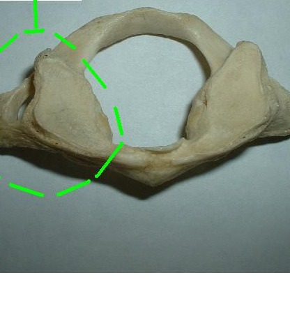 Atlas bone Flashcards | Memorang