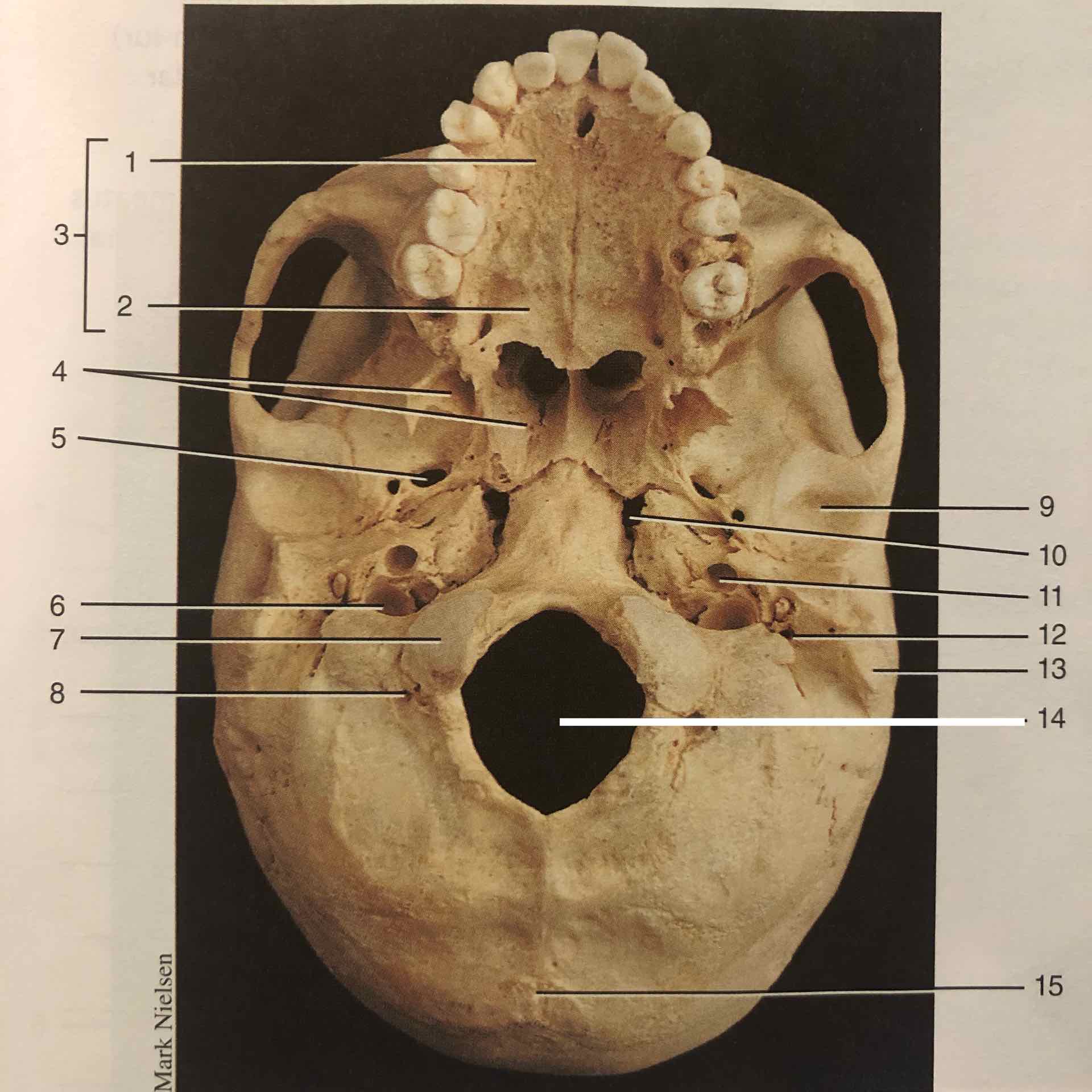 Skull Bones - Features Flashcards | Memorang